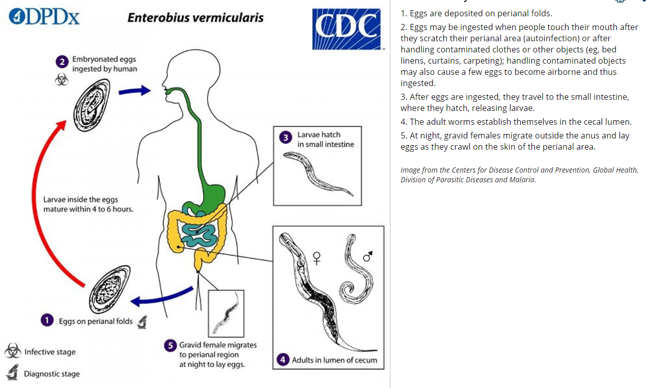 Worms – pinworm, hookworm, roundworm, whipworm – My notes