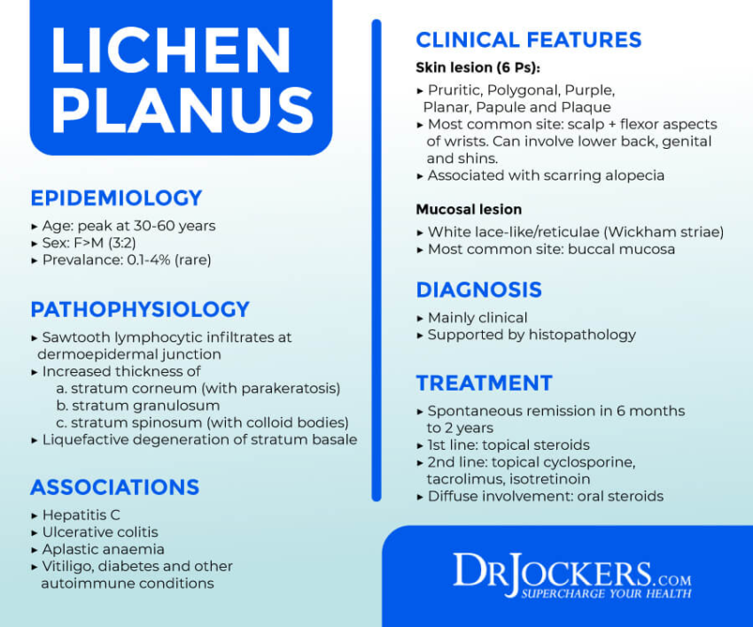 Lichen planus – My notes