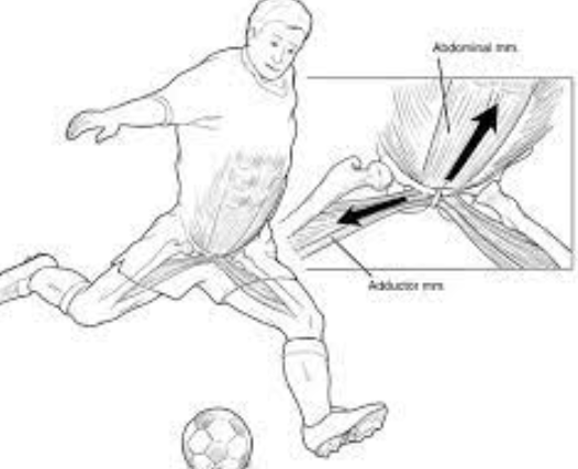 HIP msk conditions – My GP Notes