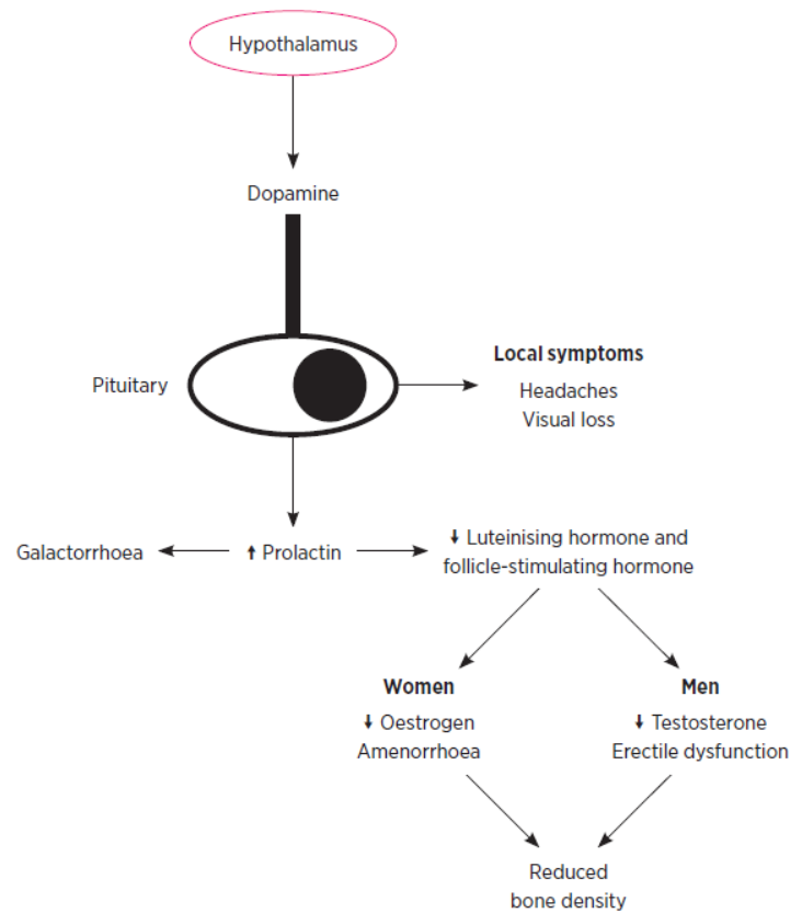 Galactorrhea – My notes